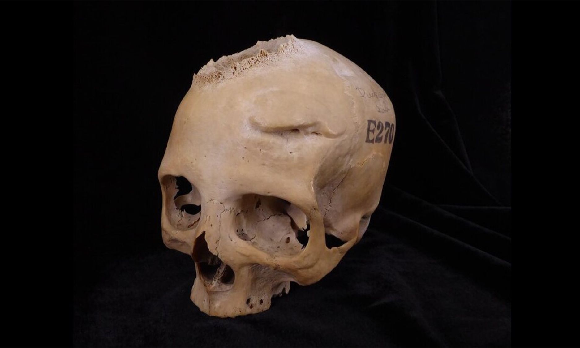 Cut marks on 4,000-yr-old skulls show ancient Egyptians tried to treat ...