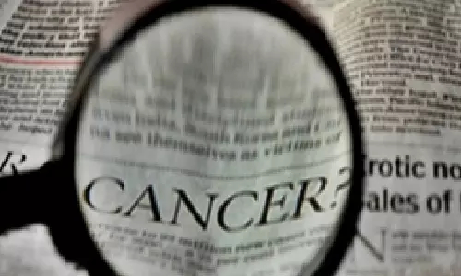 Early-onset colon cancer cases surge globally; lowest in India: Study