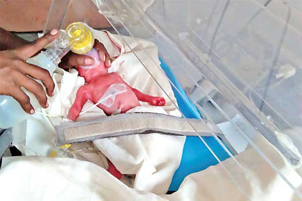 Baby declared dead by docs found alive before burial