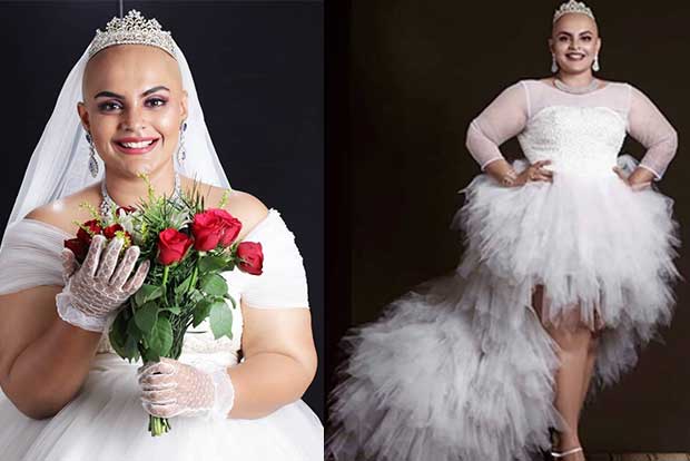 Plus-size model endorses ‘bald is beautiful’ campaign for cancer awareness