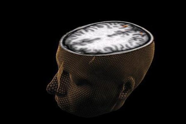 Bolt to the brain to serve as alternative neuro-therapy